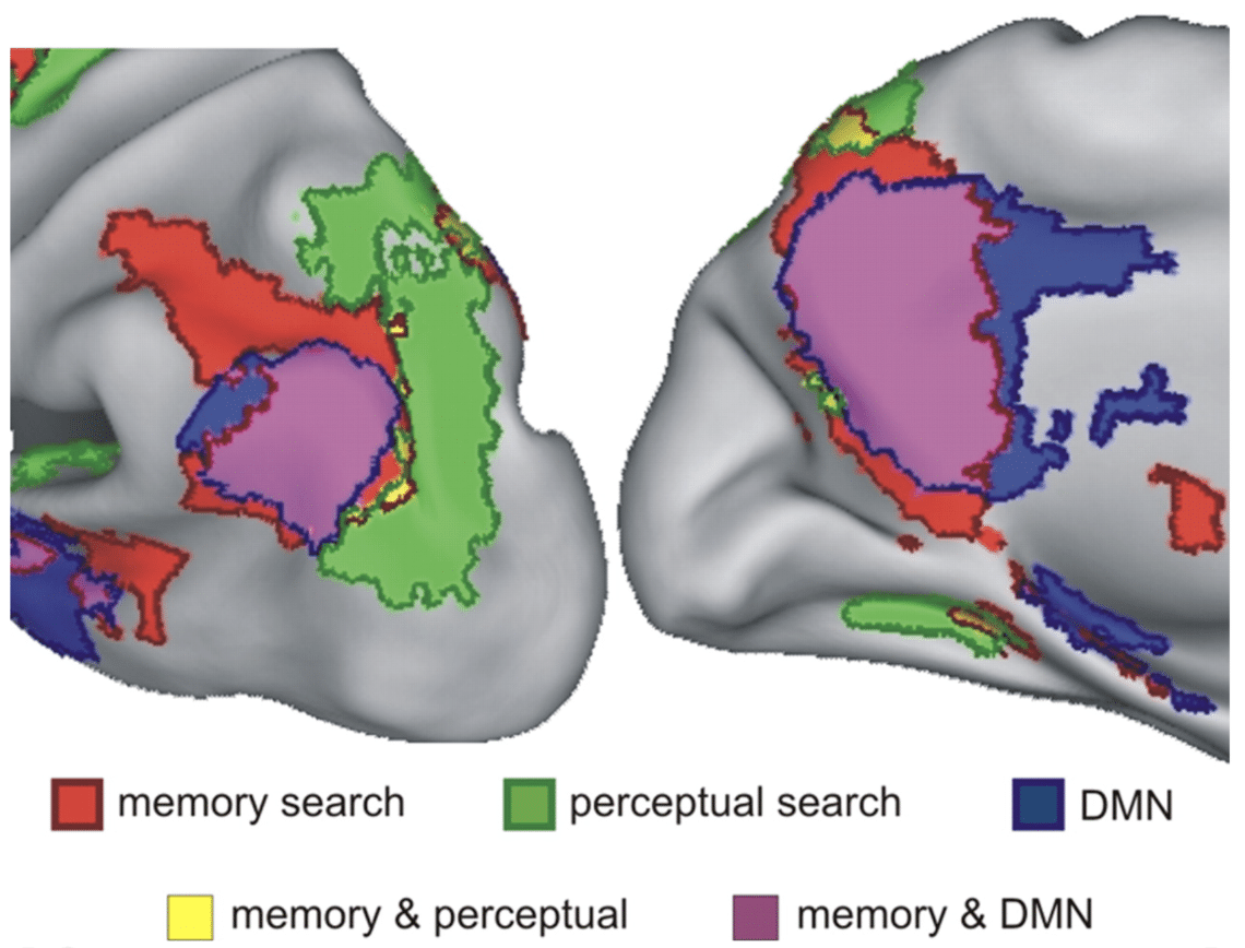 Lobo parietal: anatomia macroscópica, principais funções e correlações ...