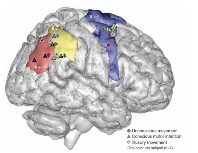 Lobo parietal: anatomia macroscópica, principais funções e correlações ...