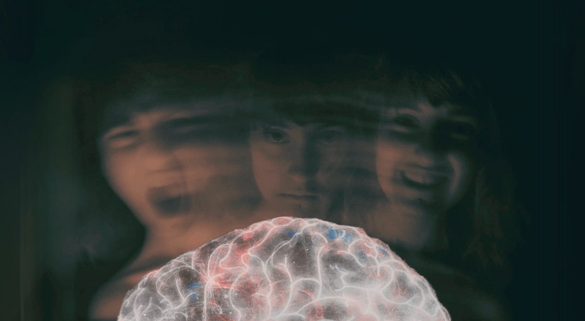 Cerebro Com Transtorno De Personalidade Narcisista Narcisismo E